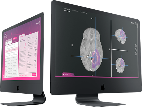 AI for Automated Medical Imaging Segmentation | Minerva Segmentations